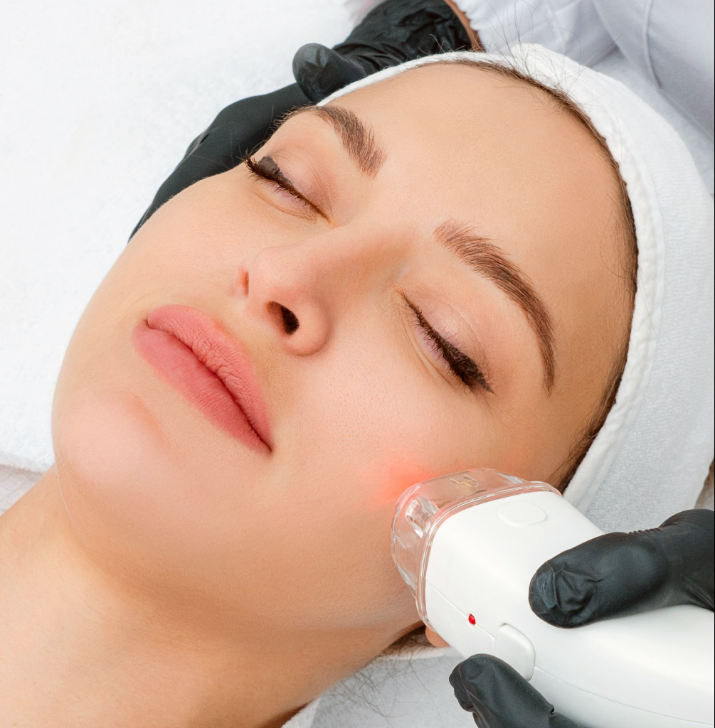 IPL Treatment in Georgia | Intense Pulsed Light Treatments
