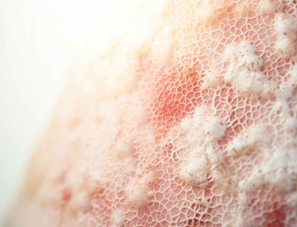 Heal Sun Damage With Skin Care Tips From The Experts